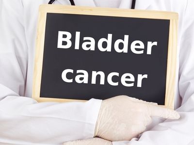 Actos Bladder Cancer Lawsuit Jointly Filed By 6 Plaintiffs