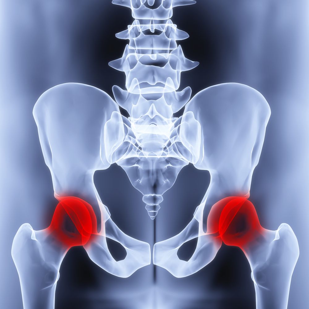Biomet M2a Magnum Hip Implant Blamed for Pain, Revision Surgery