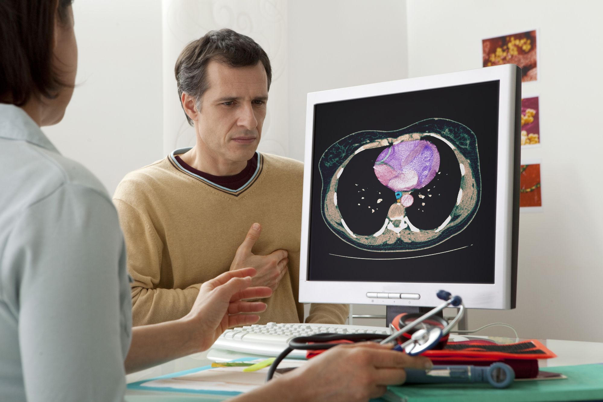 Dilantin Brain Atrophy May Impair Job-Related Skills