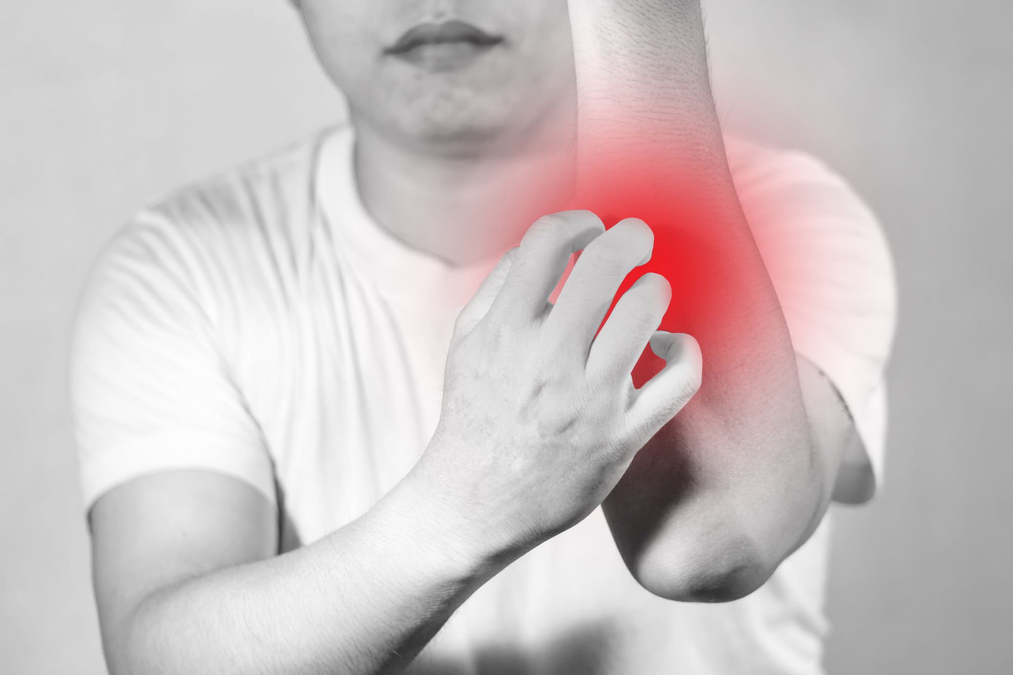 Dealing with the Results of Dilantin Steven Johnson Syndrome