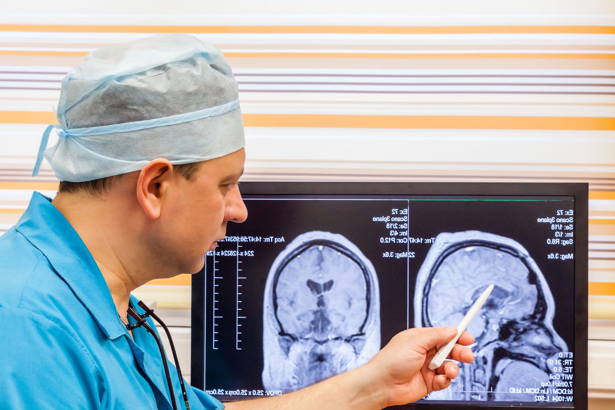 Dilantin Brain Side Effects Can Lead to Problems with Movement