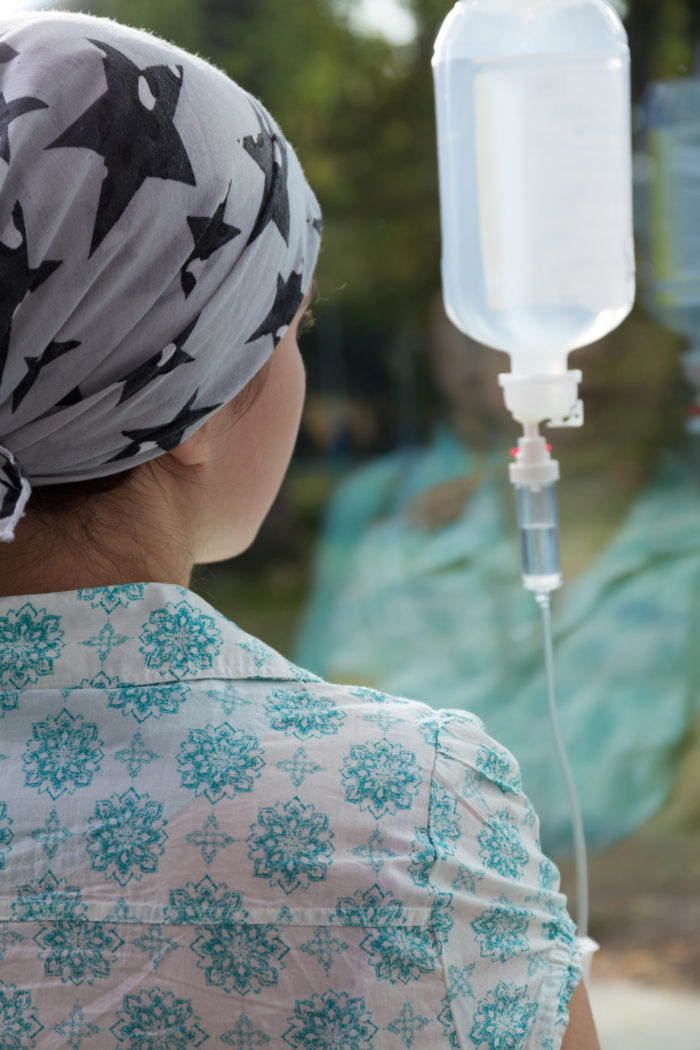 Another Cancer Patient Suffers Disfiguring Permanent Alopecia