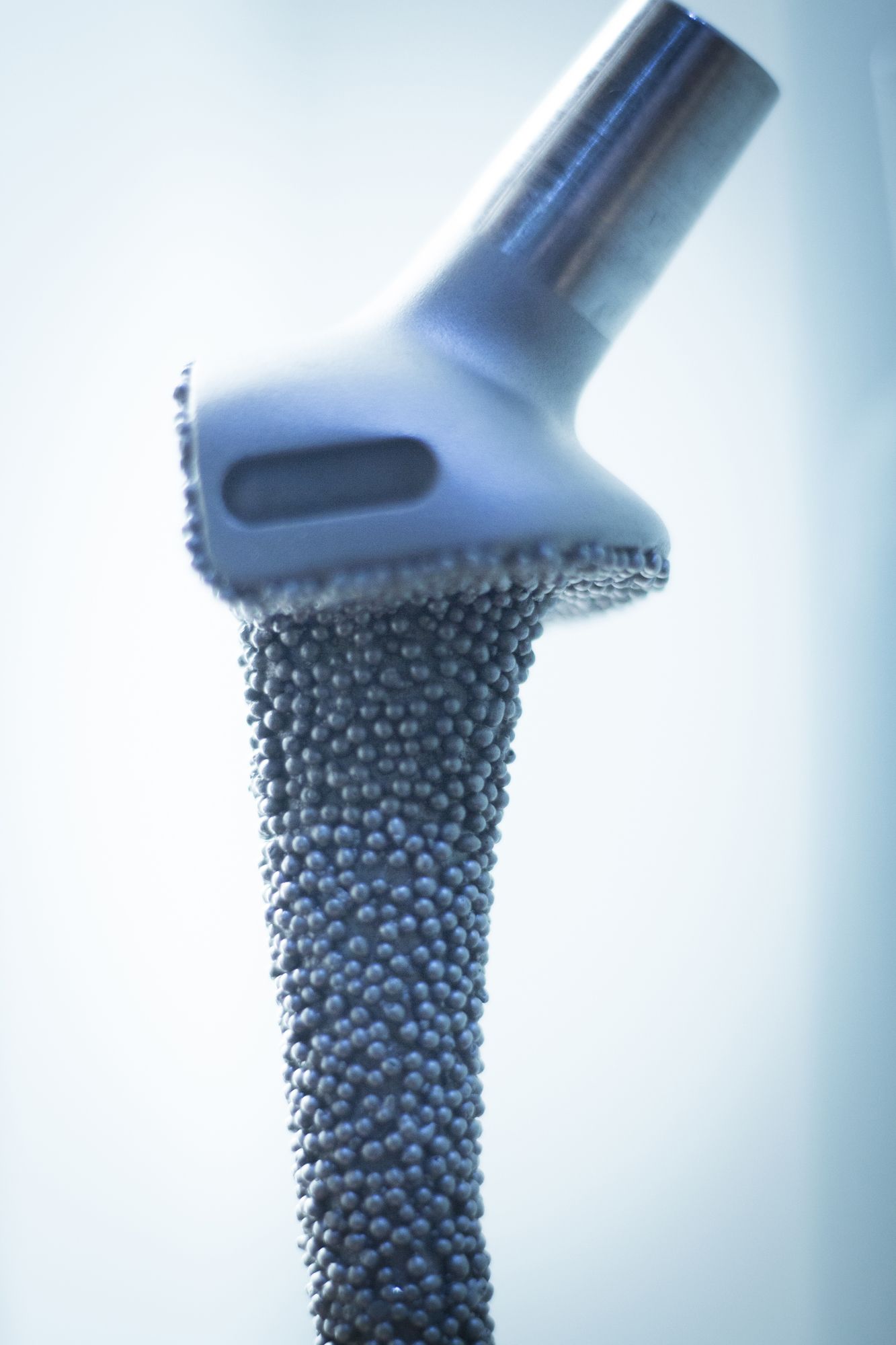 DePuy Pinnacle Hip Replacement Lawsuit Alleges Manufacturer Negligence
