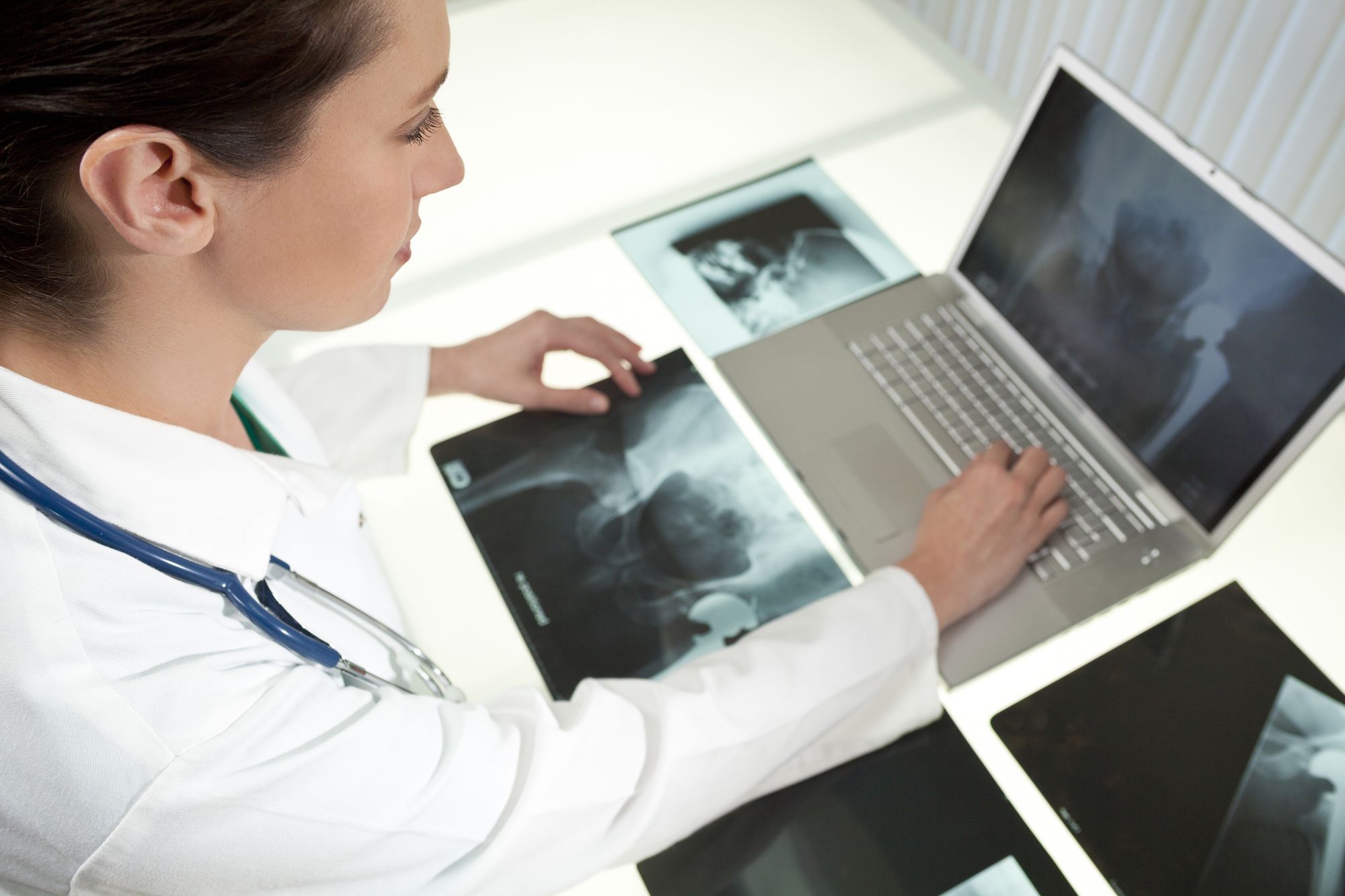 ASR Hip Replacement Settlement Available for Revision Patients