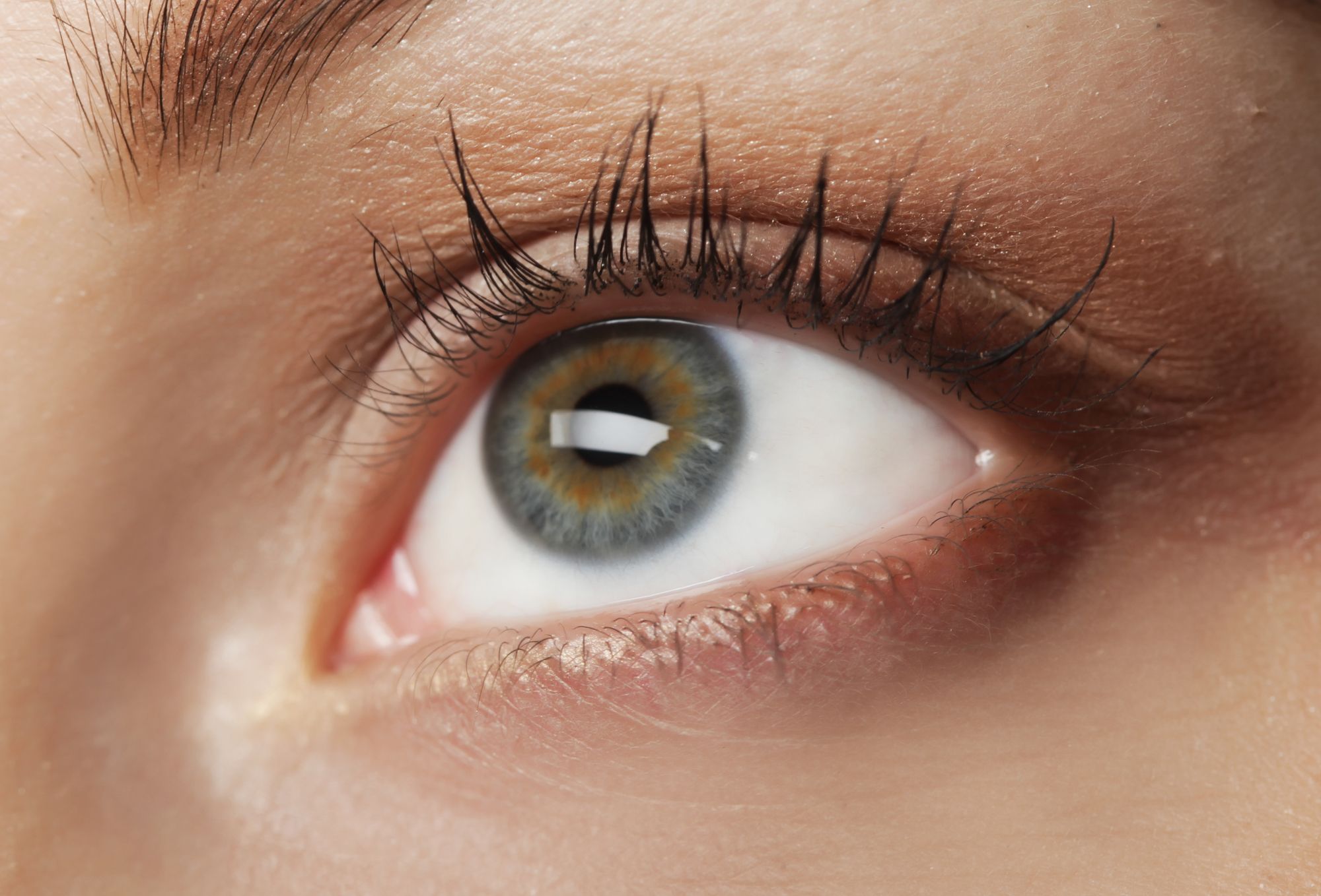 The Significance of Floaters after Eye Injection with Avastin
