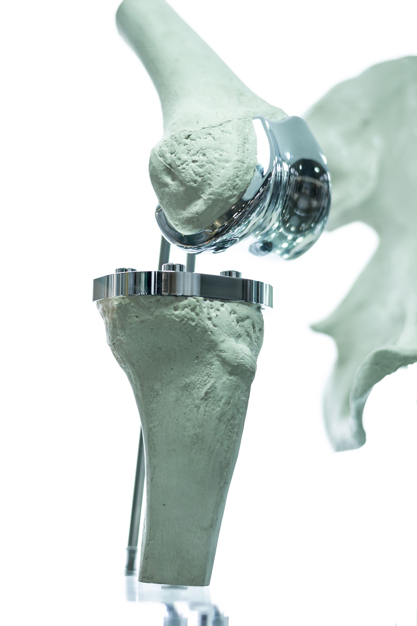 Couple Bring Zimmer Persona Lawsuit to U.S. District Court