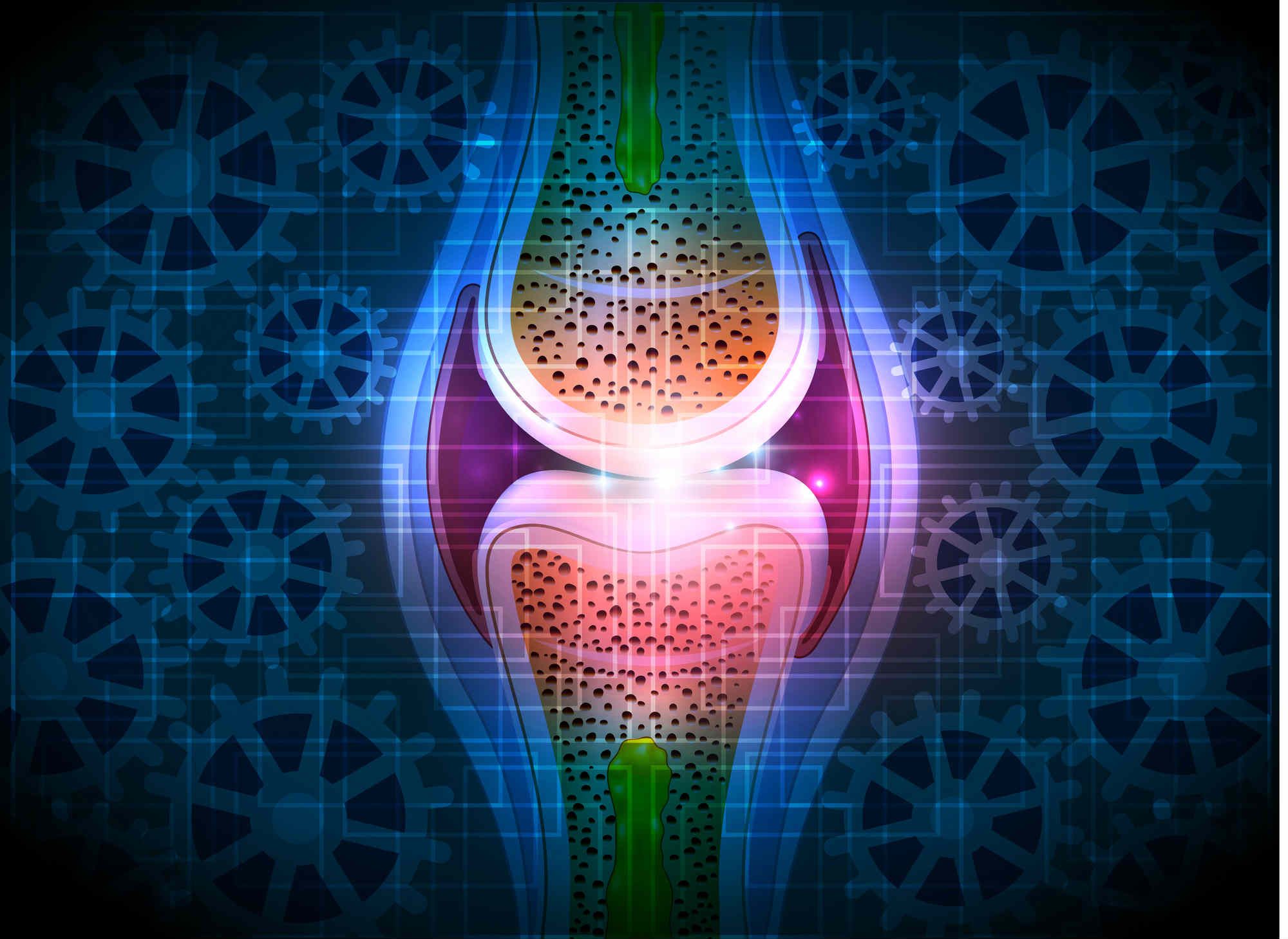 Exactech Knee Implant Components Might Wear Out or Contain Recalled Parts