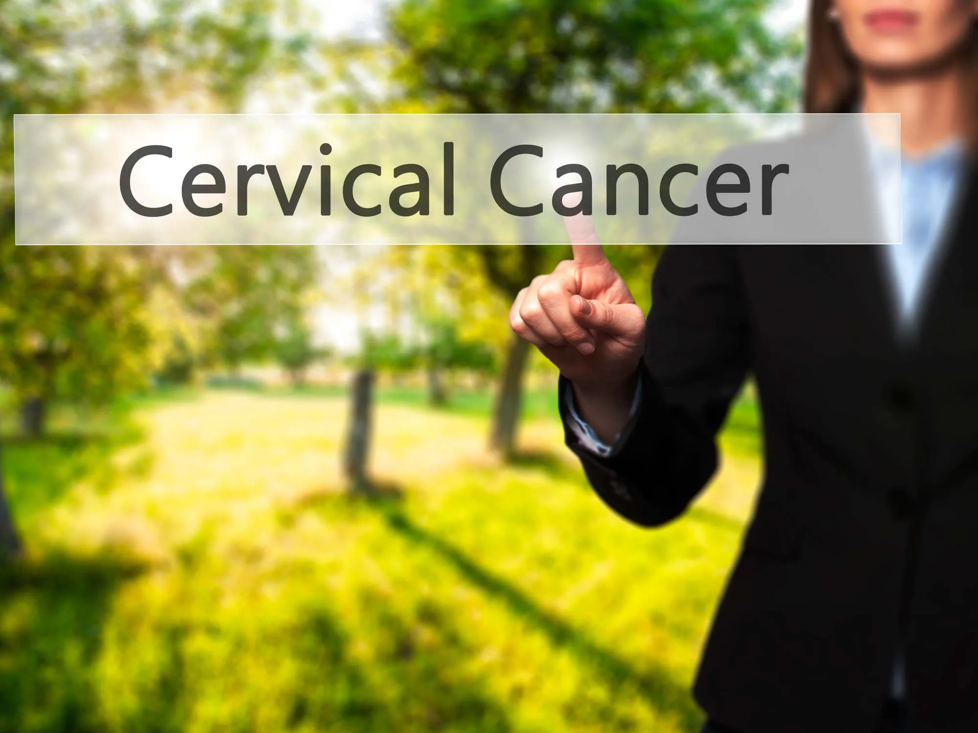 Cervical Cancer Missed Diagnosis Linked to False Negative Pap Smear Results