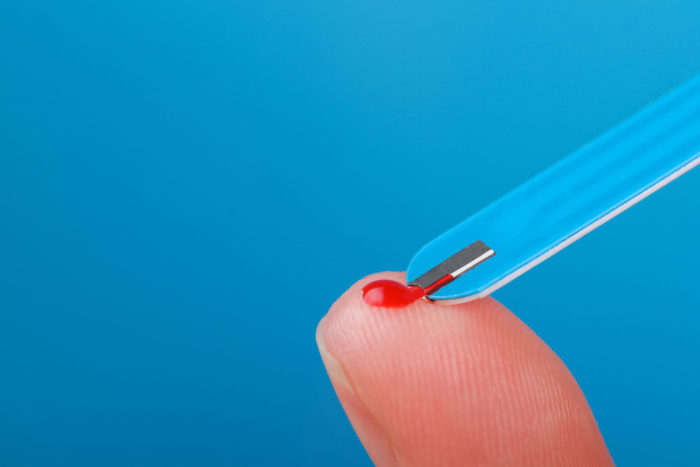 Actos Side Effects Lawsuit Alleges Diabetes Drug Caused Bladder Cancer