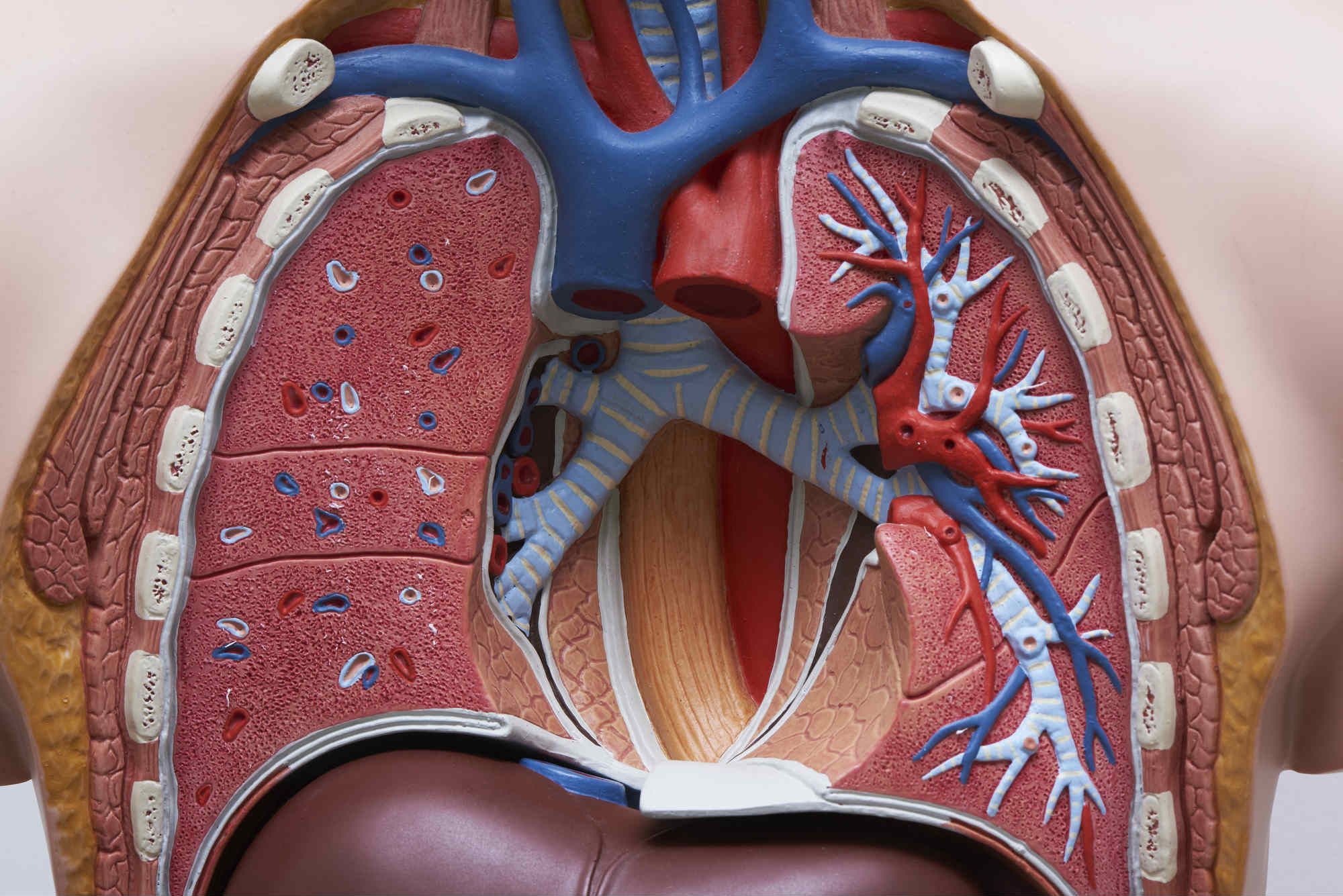 Cook Celect IVC Filter Complications Are Common, Lawsuit Claims