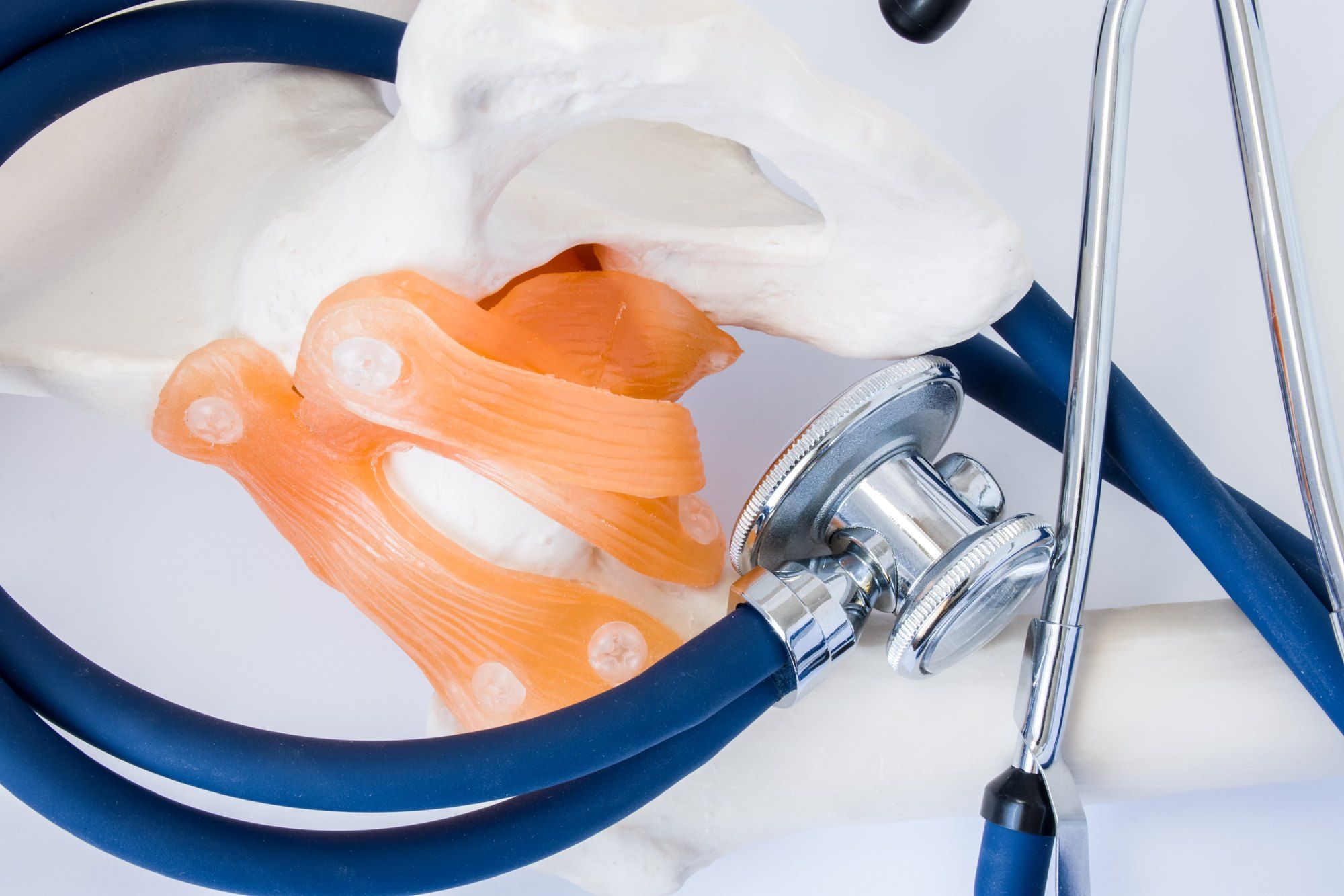 DePuy Lawsuit Says ASR Hip Implant Device Causes Long-Term Injuries