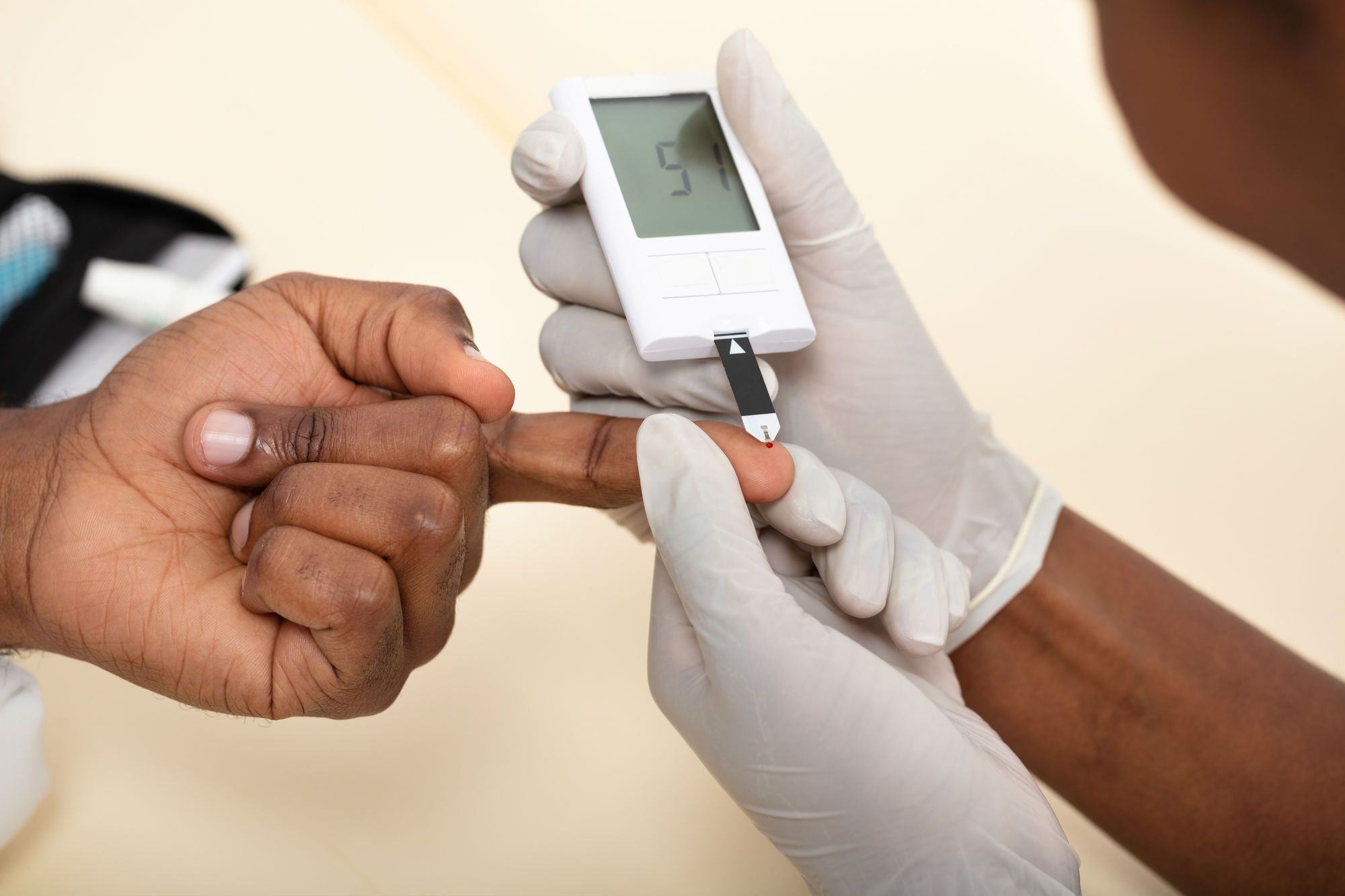 What Diabetes Medicine Causes Diabetic Limb Amputation?