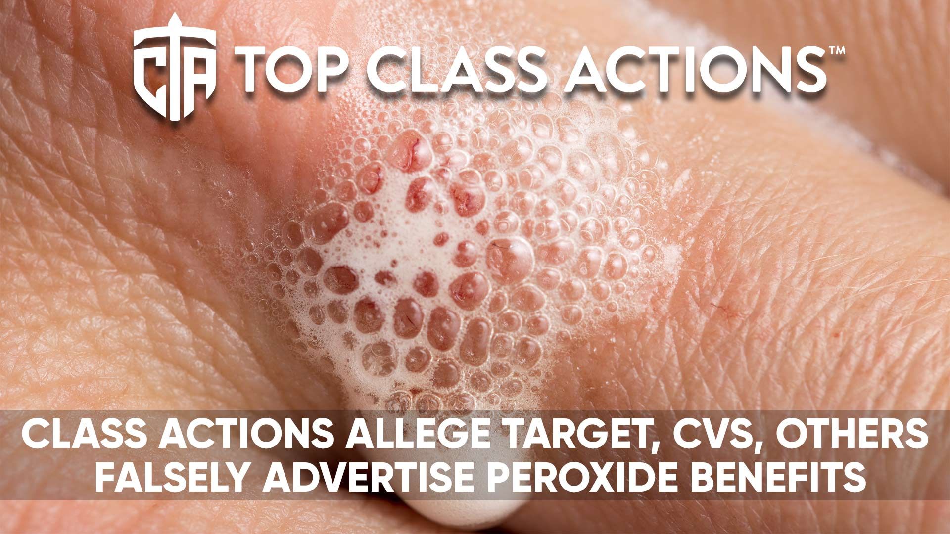 Class actions allege Target, CVS, others falsely advertise peroxide ...